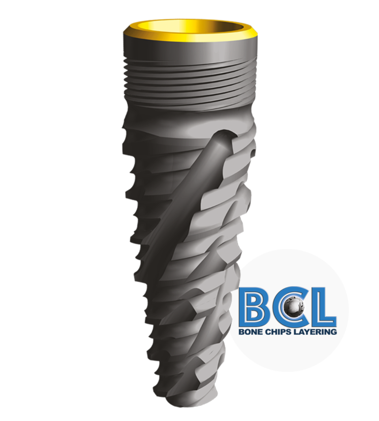 Home page | Intra-lock System Europa srl